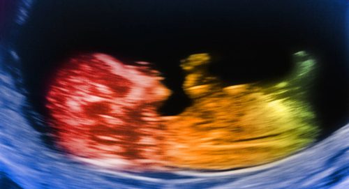 Unfathomable number of preborn children killed by abortion since Roe v ...